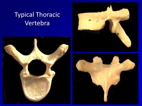 Typical Thoracic Vertebra Diagram Quizlet