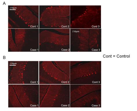 Calbindin Immunofluorescent Staining In The Cerebellar Cortex