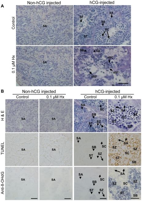 A Representative Light Micrographs Of Non HCG Injected And Download Scientific Diagram