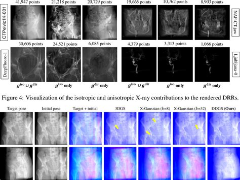 Figure 1 From Ddgs Ct Direction Disentangled Gaussian Splatting For Realistic Volume Rendering