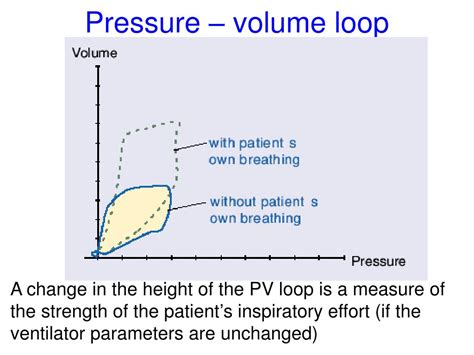 Ppt Interpretation Of Ventilator Graphics Powerpoint Presentation