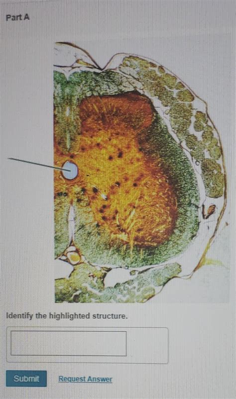 Solved Identify The Highlighted Structures Identify The