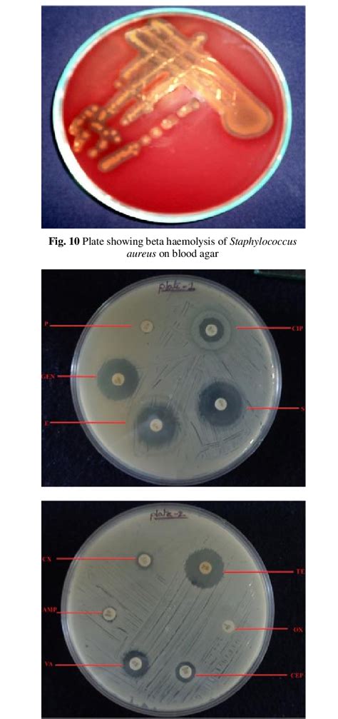 And 12 Plates Showing Antibiotic Resistance Of Staphylococcus Aureus On