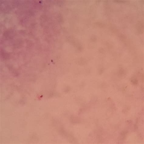 Malaria Data Test Object Detection Dataset By Emir Fachrudin