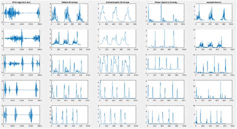Figure 3 From Hsnet Enhancing Cardiovascular Health Detection Through Advanced Signal