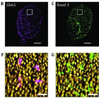 Identification Of Glut And Band In The Topography Of The Cytoplasmic Download Scientific