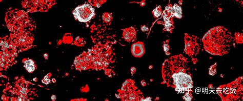 使用image J进行细胞照片背景优化——批量化处理 知乎