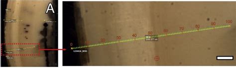 Synchrotron X Ray Microdiffraction To Study Dental Structures In