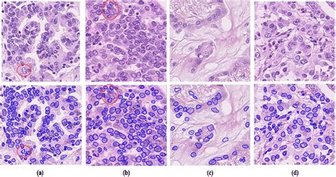 Nuclei Segmentation Results Using Veta Et Al 32 On Lung Adenocarcinoma