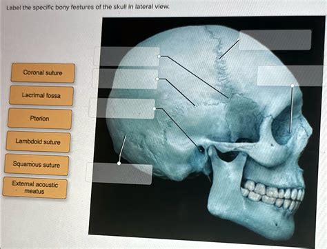 Label The Specific Bony Features Of The Skull In Lateral View