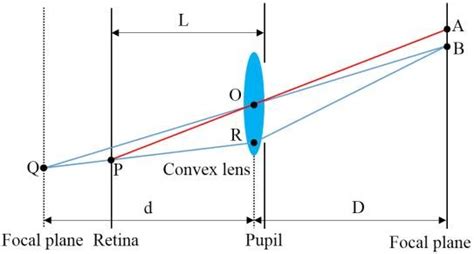 The Optical Path Of Hyperopia With Less Rays Download Scientific Diagram