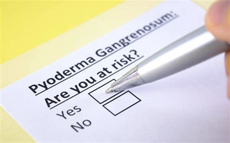Pyoderma Gangrenosum Symptoms And Causes Lifebei