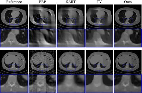 Computed Tomography Reconstruction Using Generative Energy Based Priors