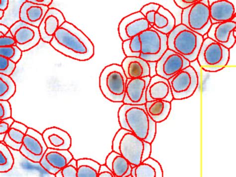 Object Classifier Error Usage Issues Image Sc Forum