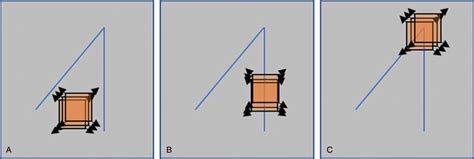 Stepwise Local Stitching Ultrasound Image Algorithms Based O Medicine