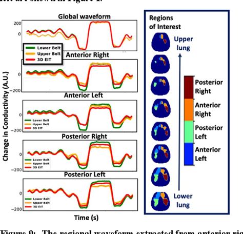 Spirometric Lung Function At Jerome Weeks Blog