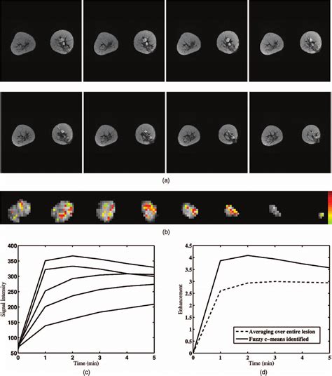 Illustration Of The Curve Identification Method A 3d Breast Mr Images Download Scientific