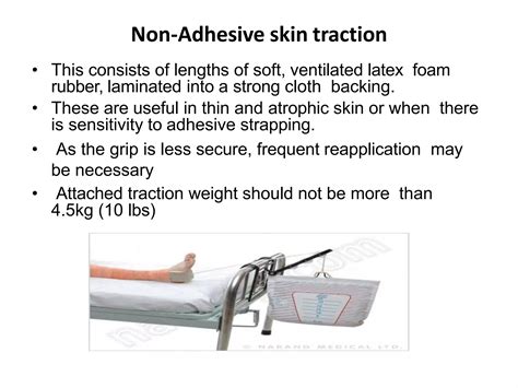 Splints And Tractions In Orthopaedics By Dr Atulpptx