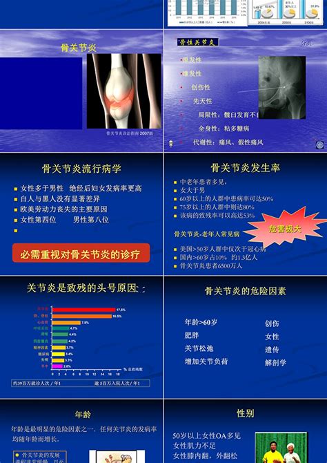 膝关节骨性关节炎的阶梯治疗ppt模板卡卡办公