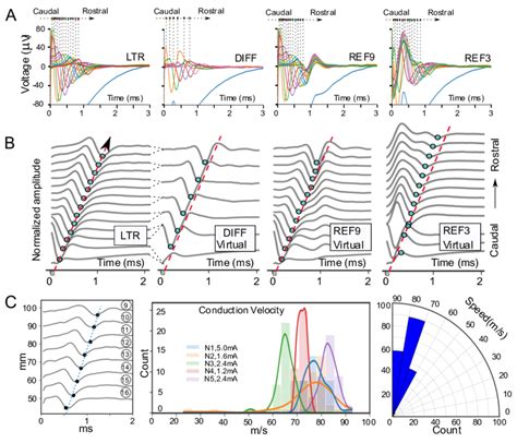 The Effect Of Referencing Method On Ecap Component Amplitude And