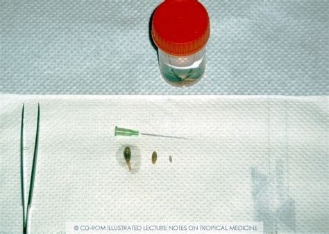 Myiasis Wikitropica