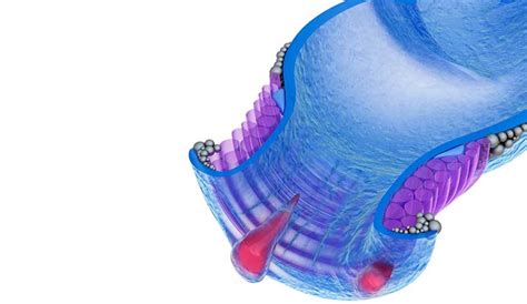 Thd Treatment Colorectal And Gastro Clinic Colon Cancer