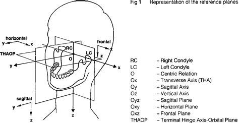 [pdf] Kinematics Of Mandibular Motion In The Sagittal Plane 1 Kinematics Of Mandibular Motion In