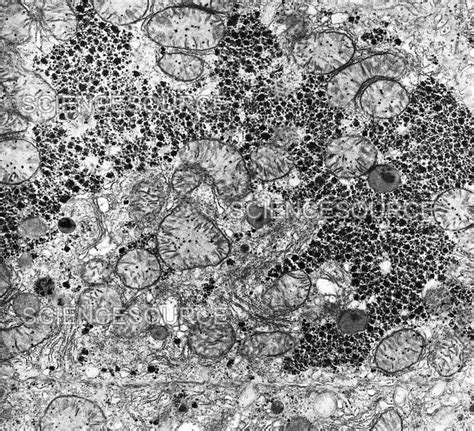 Liver Cell Electron Micrograph
