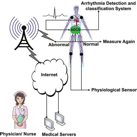 The Overall Architecture Of Arrhythmia Detection System Download Scientific Diagram