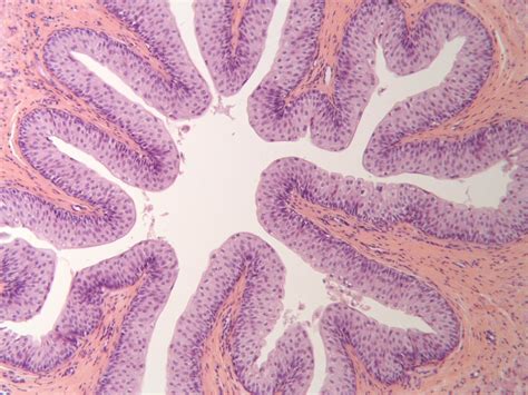 Diagram Of Transitional Epithelium Slide Quizlet