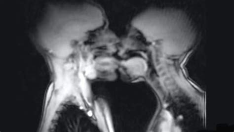 Sådan Ser Sex Ud Indefra Se Videoen Feminadk