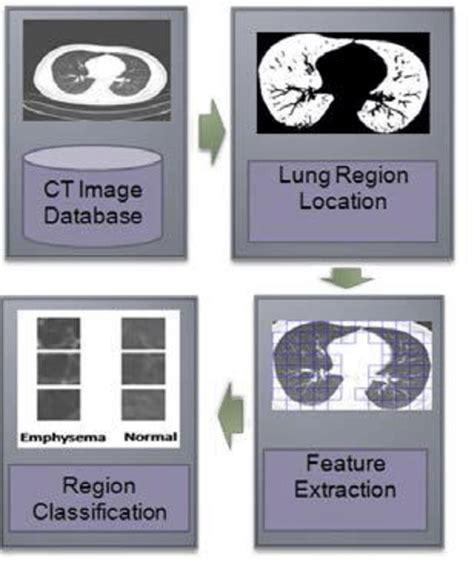 Emphysema Region Classification Scheme Picture Courtesy 4 Download Scientific Diagram