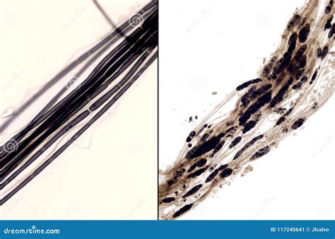 Myelinated Nerve Fibers Wallerian Degeneration Stock Image Image Of Schmidt Central 117240641