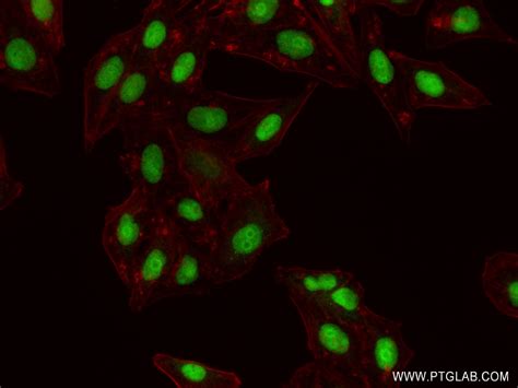 Nsun2 Antibody 82894 1 Rr Proteintech