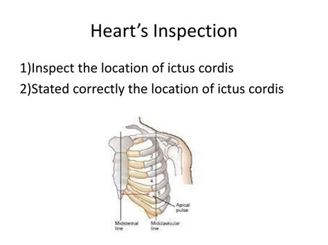 Ictus Cordis O Que é Revoeduca
