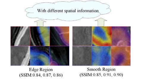 Entropy Aware Dynamic Path Selection Network For Multi Modality Medical Image Fusion Louaq
