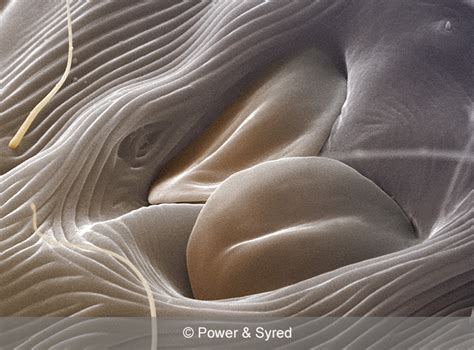 Insect Genitalia Ps Micrographs Insect Genitalia Ps Micrographs