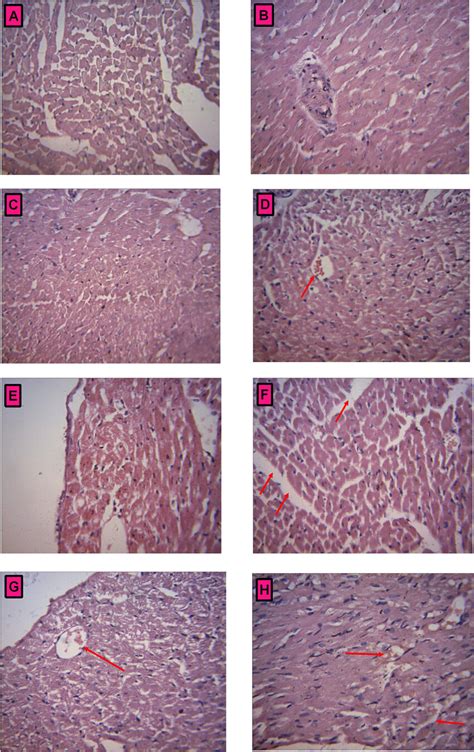 Representative Photomicrographs Showing Hematoxylin And Eosin Stained