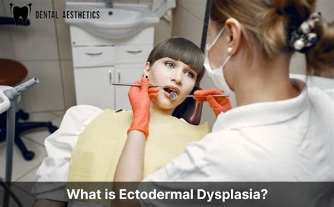 Understanding Ectodermal Dysplasia And Its Dental Effects