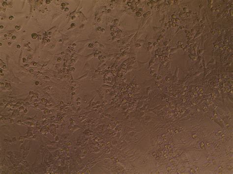 Can Anyone Explain The Debrisjunk In My Mef Cell Culture Researchgate