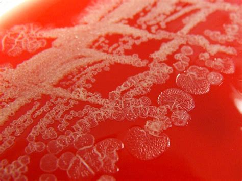 Bacterias Actuaciencia Pseudomonas Stutzeri Y Sus Colonias Escarchadas