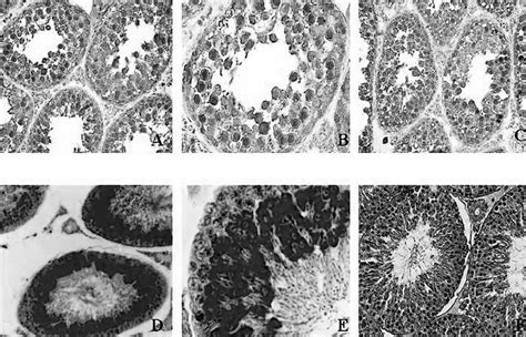 Localization Of HABP Proprotein In Testes From Spermatogenic Arrested