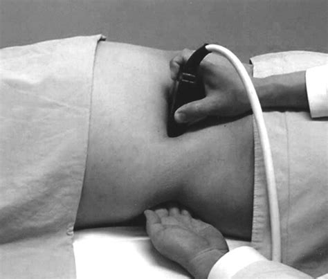 Appendicitis Critical Care Sonography