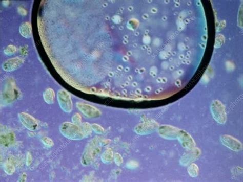 Colpidium Protozoa Stock Video Clip K0042334 Science Photo Library