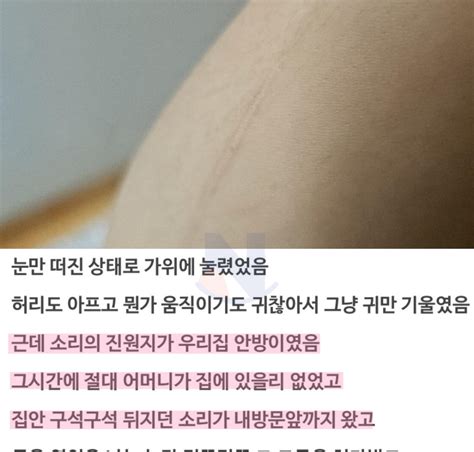 피키캐스트 식물인간인 척해서 살아남았던 썰 내용 보기 댓글👇 Facebook