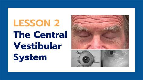 Vestibular Rehabilitation In The Geriatric Population