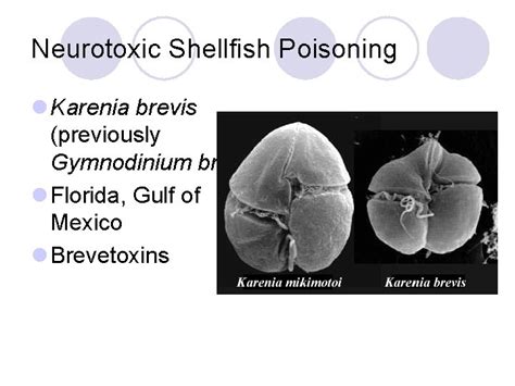 Harmful Algal Blooms What Are Habs L Algae