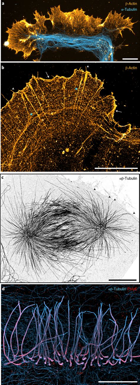 Cryo Exm Preserves Cytoskeleton Elements A Widefield Image Of