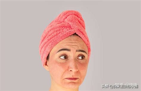 脸部角质层薄的原因？如何修复？ 知乎