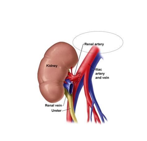 Renal Arteries Come Off The Side Of The Abdominal Aorta And Supply The